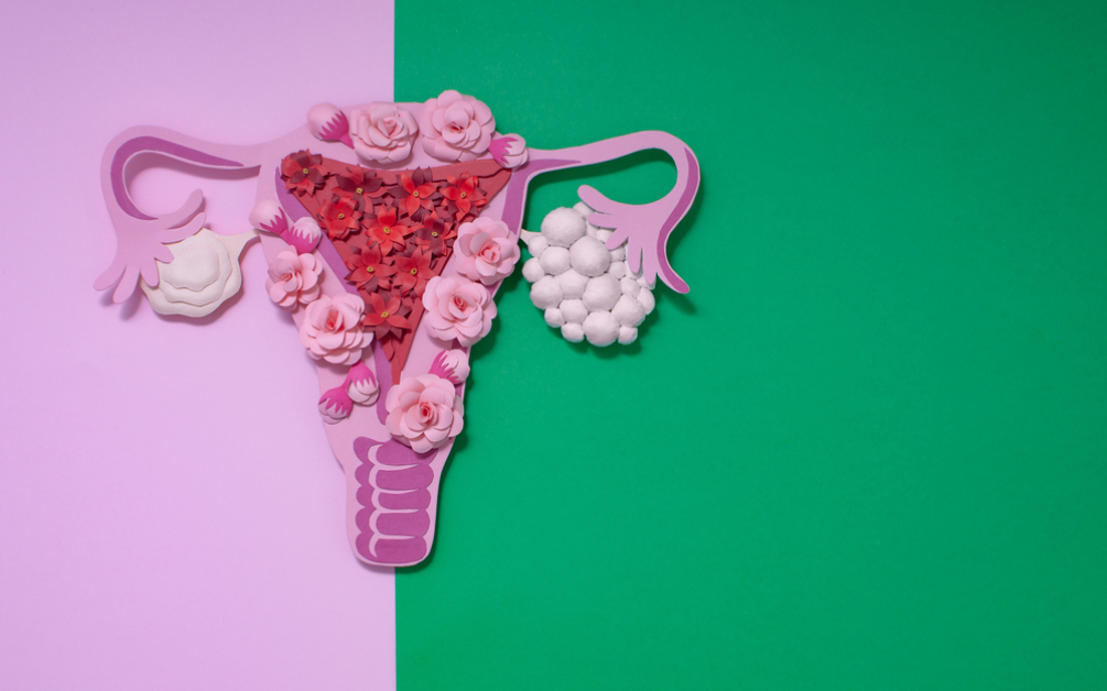 Sindromul ovarelor polichistice: cauze, simptome, complicatii